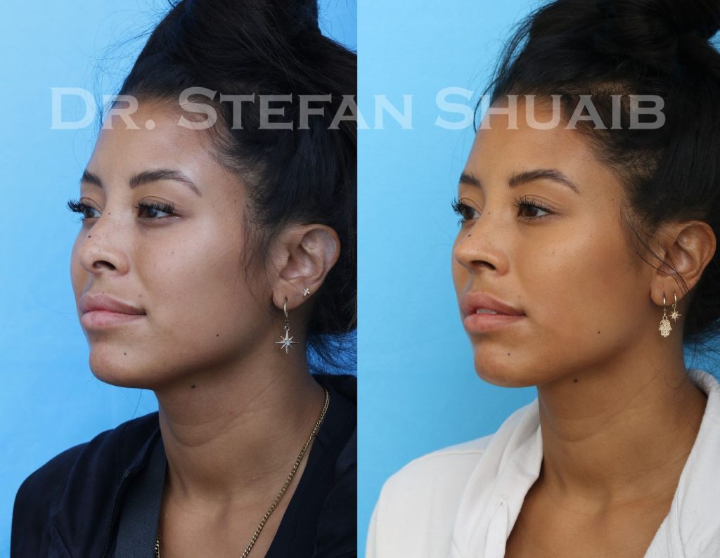 78 | Dallas Facial Plastic Surgery Center