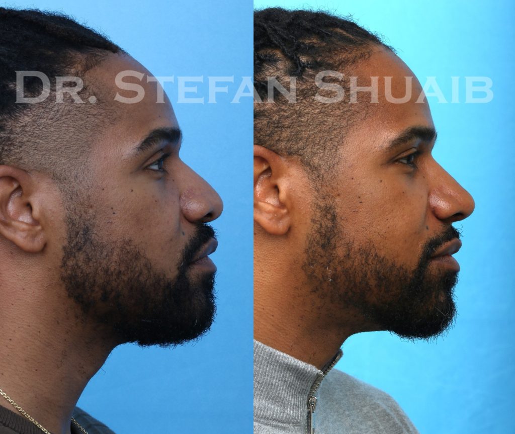 23 | Dallas Facial Plastic Surgery Center